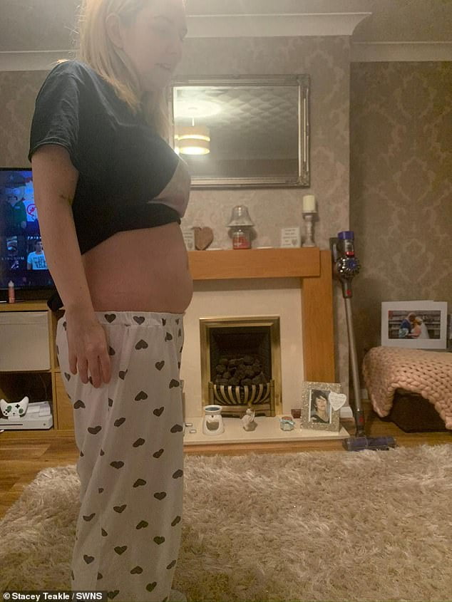 Expectant Mother Lost 3st While Pregnant After Being Sick Up To 60