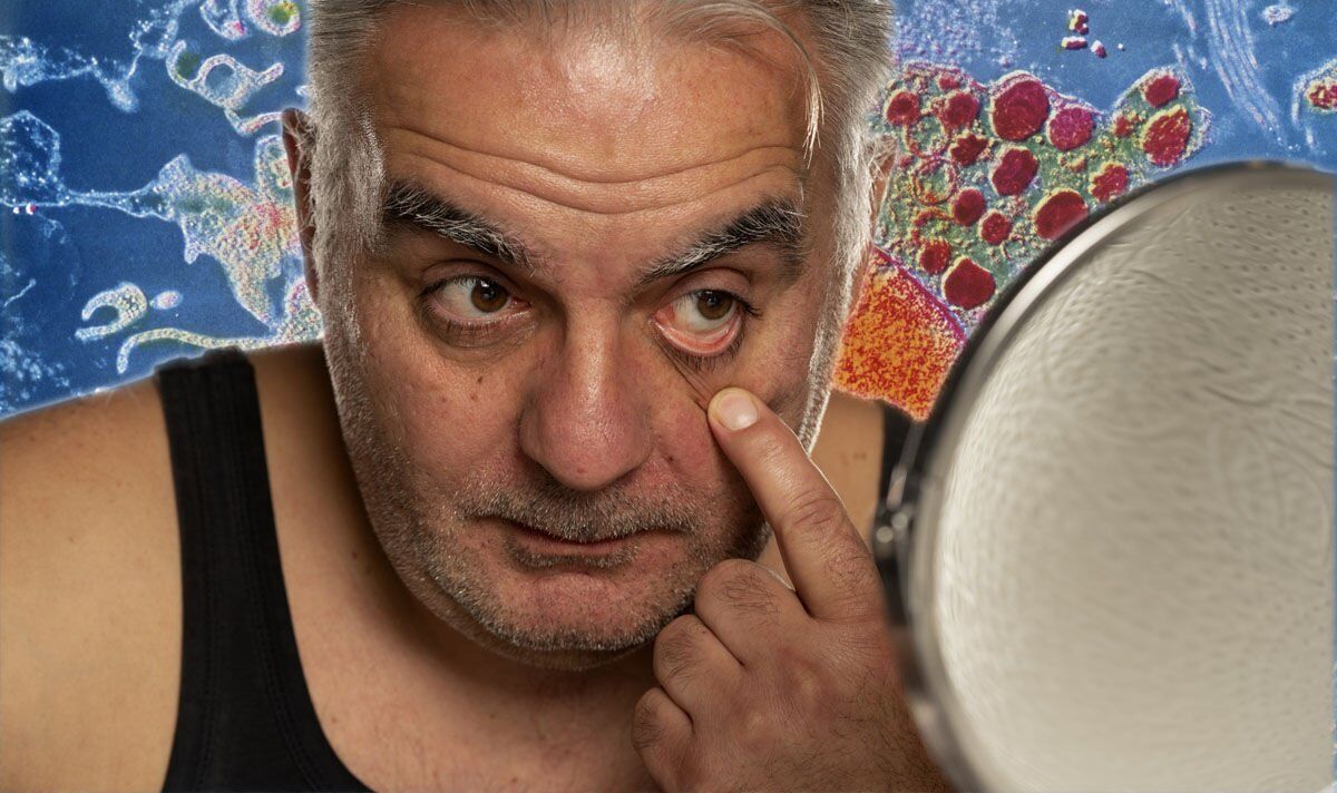 Iron deficiency symptoms: The common sign of low levels to spot inside ...