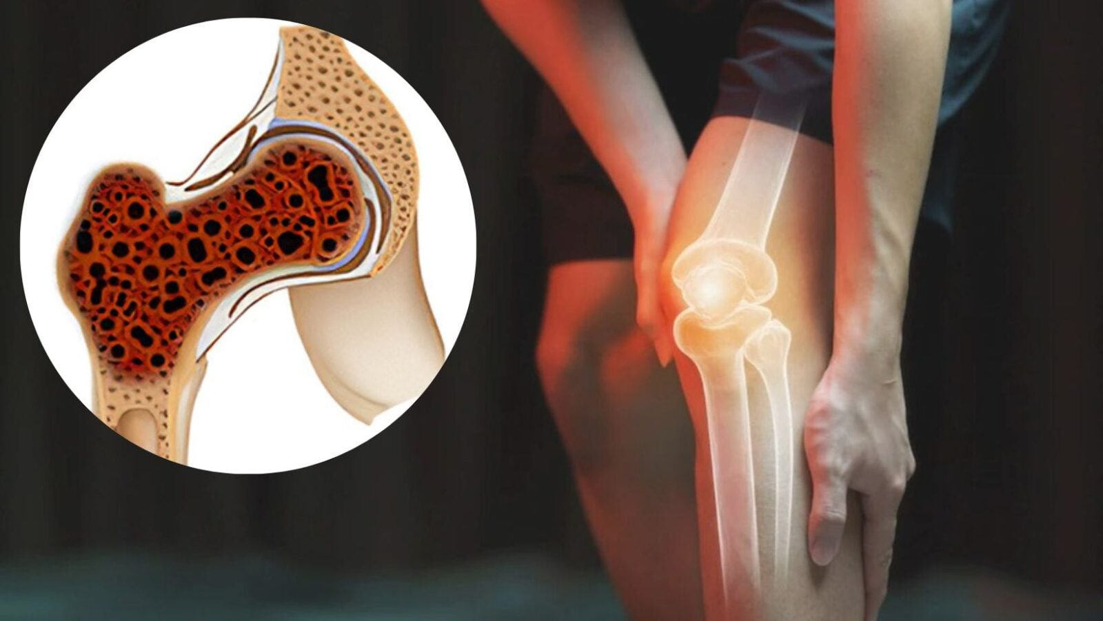 Bone Cancer Symptoms: 7 Warning Signs You Should Never Ignore - Sound ...