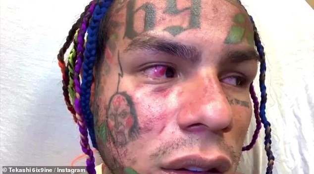 Tekashi 6ix9ine shows off painful injuries in new music video after ...